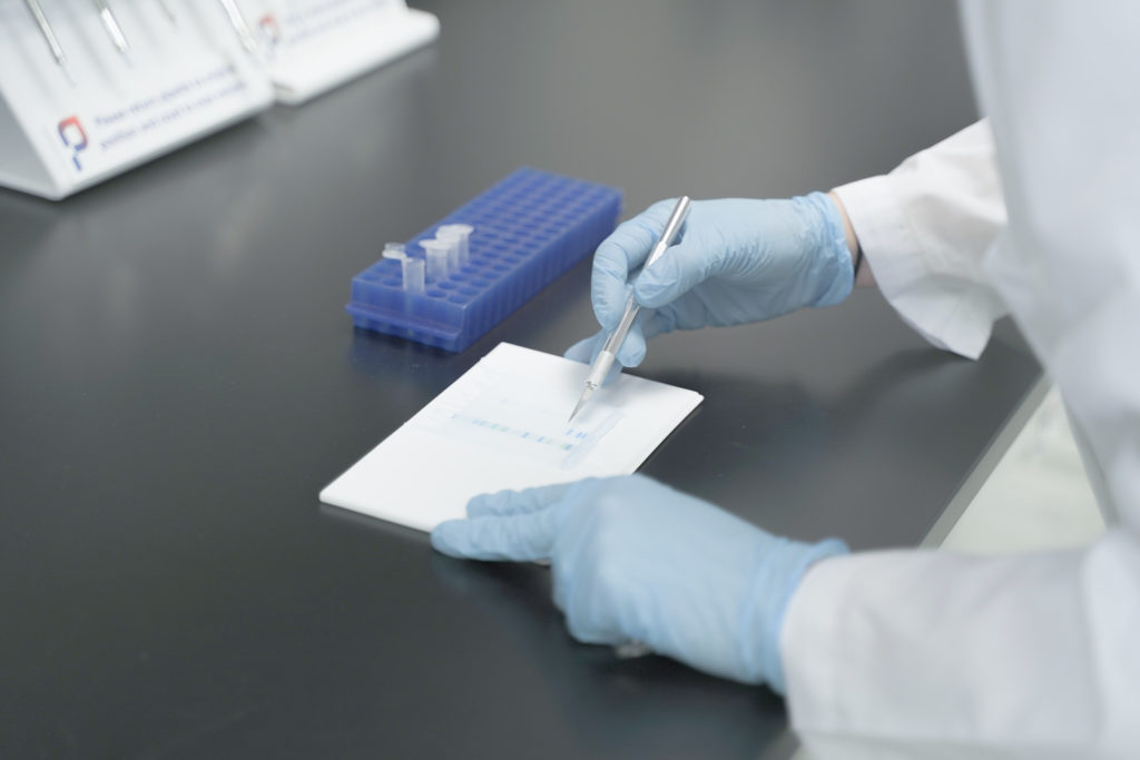 Protein Identification | Poochon Scientific